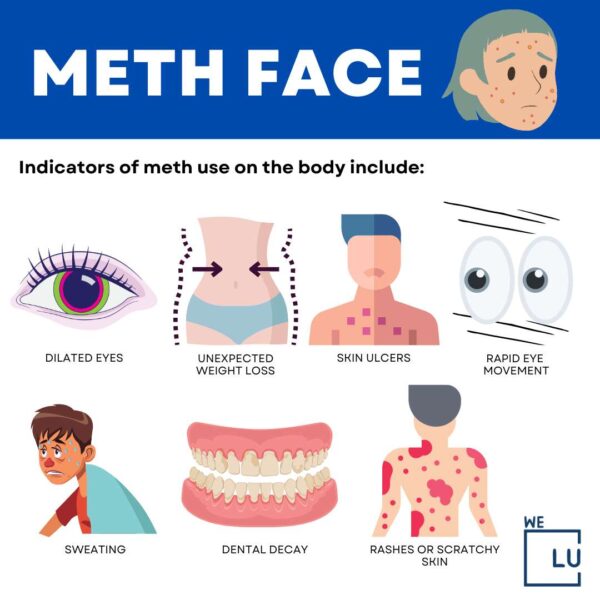 Faces Of Meth: Signs, Effects, And Health Damage