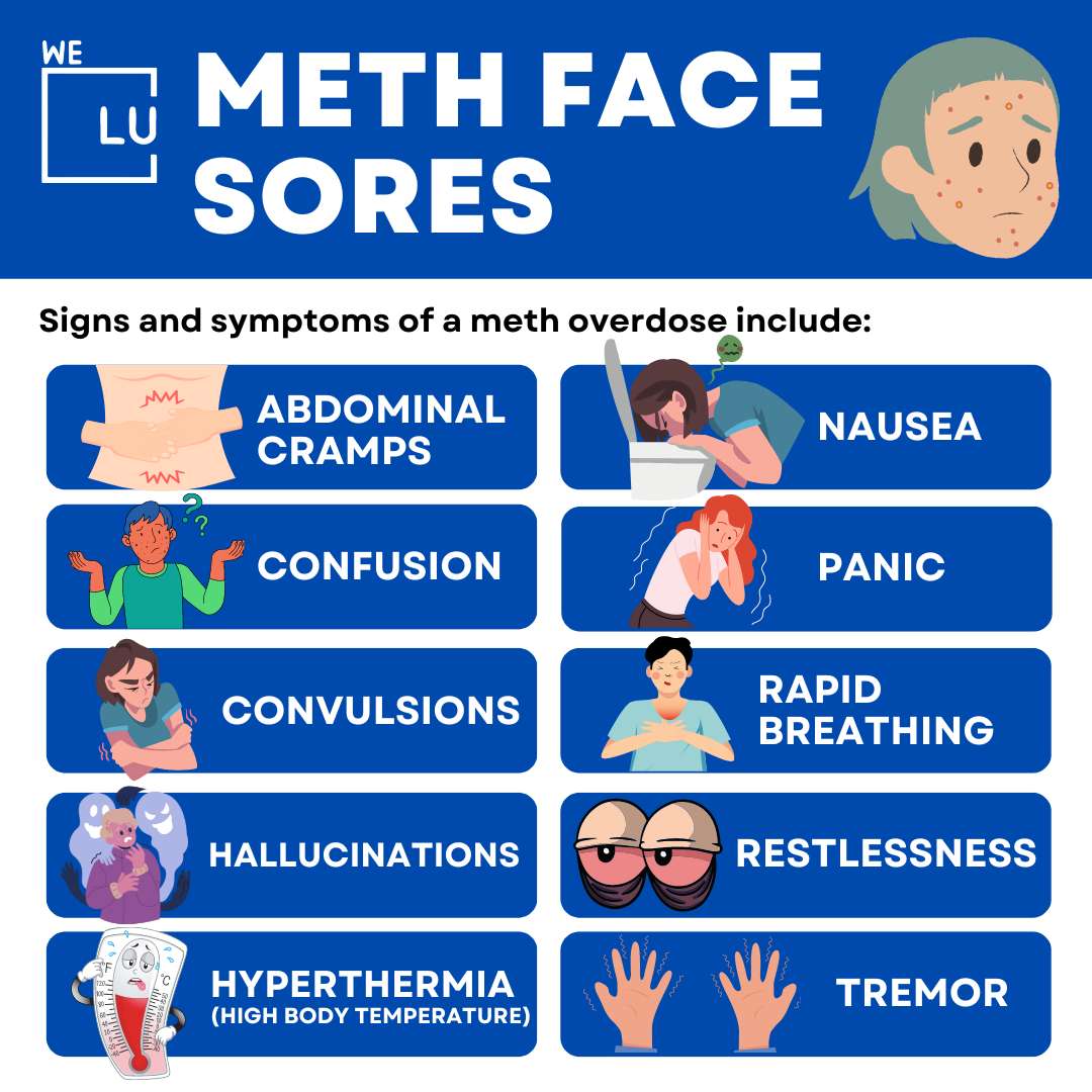 Faces Of Meth: Signs, Effects, And Health Damage
