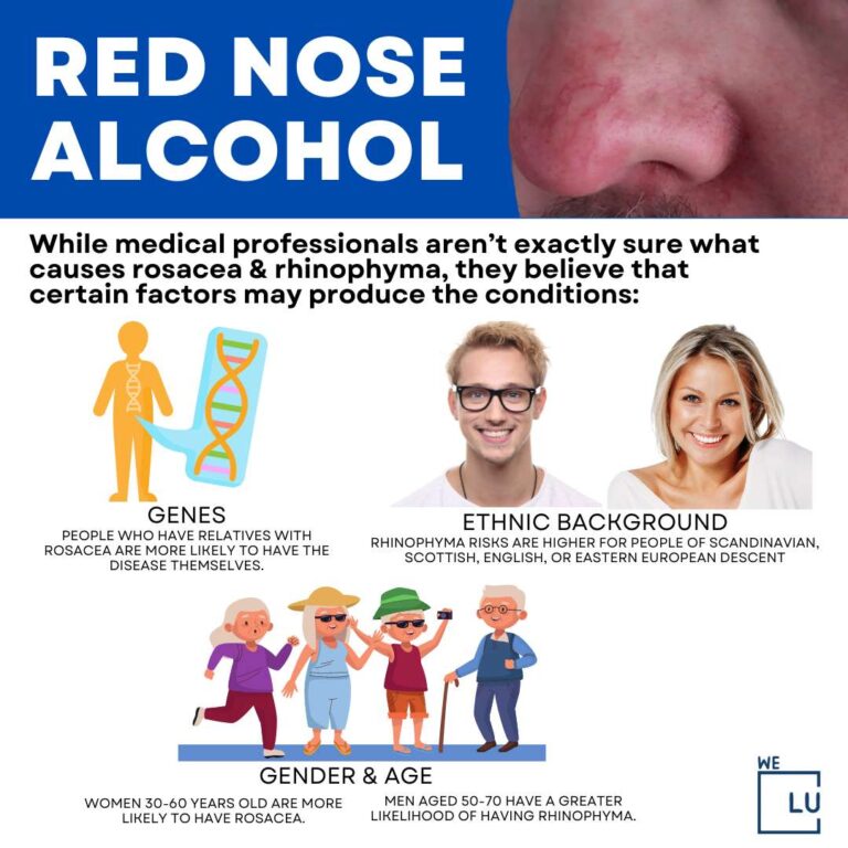 What Is Alcoholic Nose Red Appearance? Signs & How To Treat